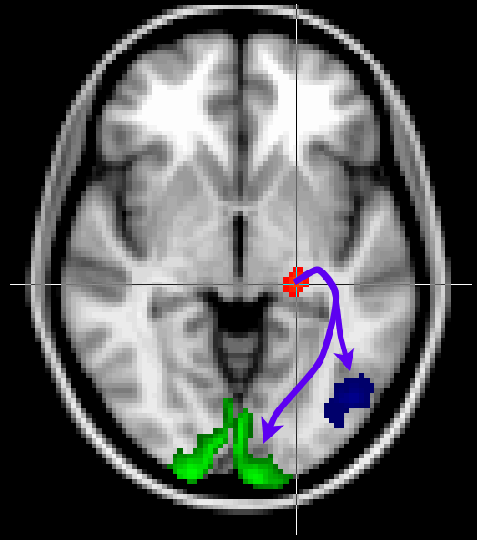 FDT Tractography Practical